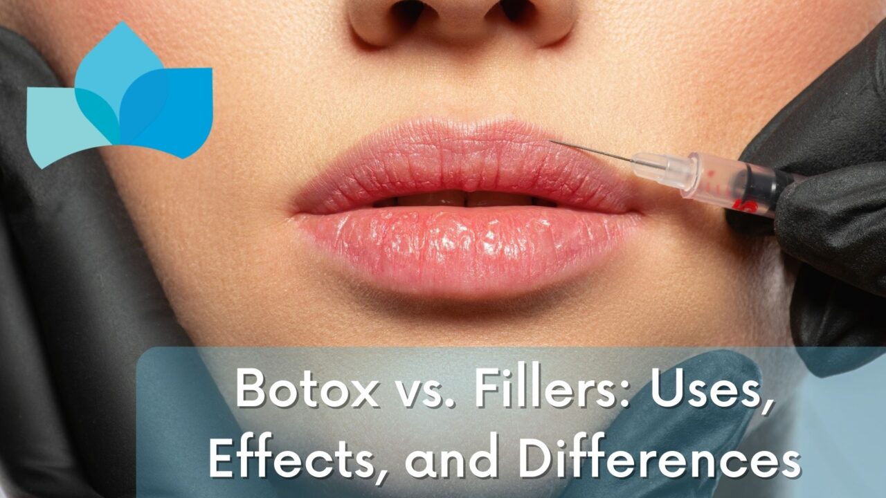 Botox vs. Fillers: Uses, Effects, and Differences - Edmonton Dermatology