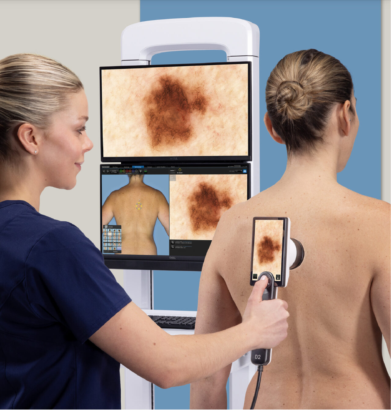 IntelliStudio Mole Mapping - Edmonton Dermatology